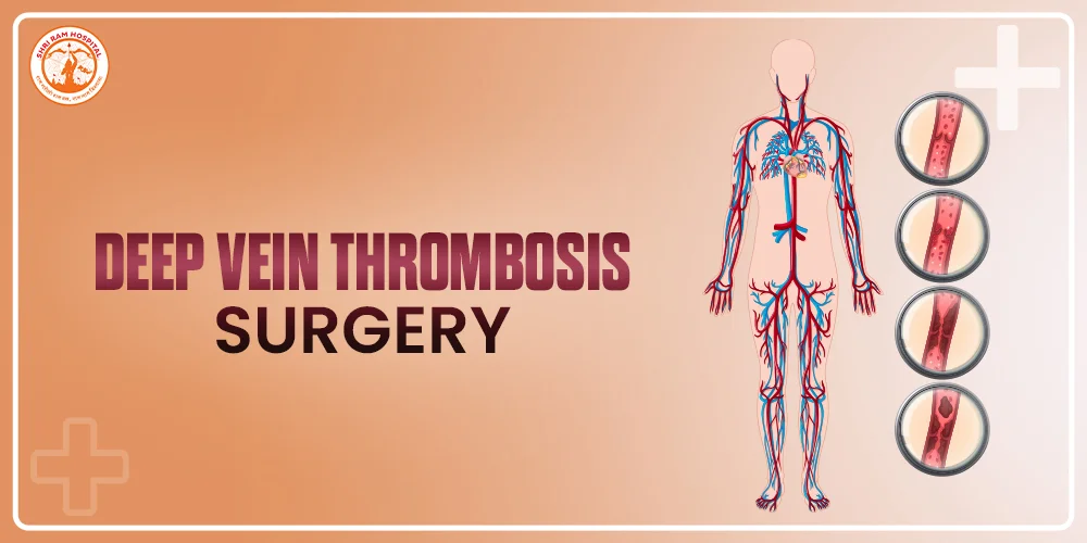 Deep Vein Thrombosis Surgical Treatment in Vikaspuri, Delhi